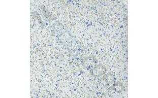 POOL360 | Marquis Series 80 lbs Exposed Aggregate Pool Finish Pool Quartz